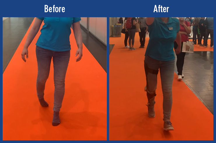 Before/After Patient Videos