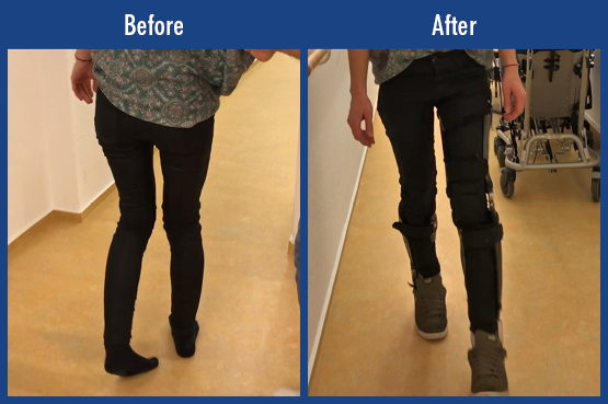 Before/After Patient Videos